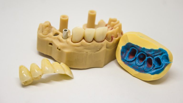 Lowe trencher teeth guide 101 - smartchefapp.com